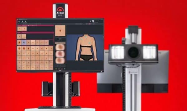 Mole Mapping - The Clifford Clinic