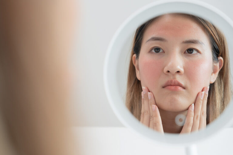 Here's Why Touching Your Face Is An Absolute No-Go for Acne