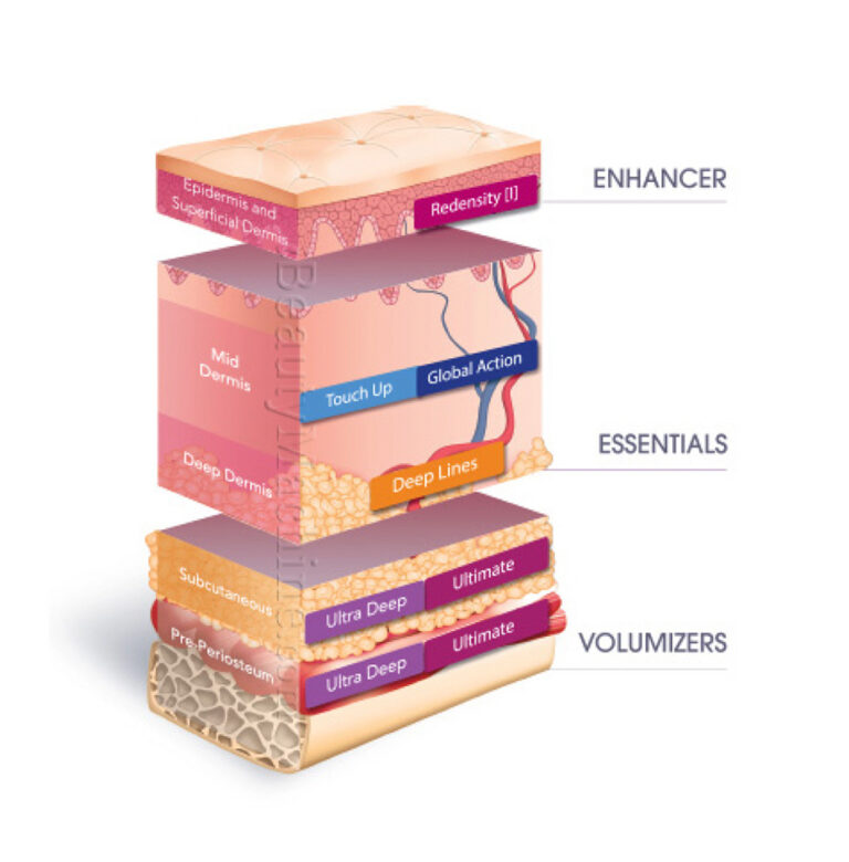 TEOSYAL® Redensity 1 Beauty Booster - The Clifford Clinic